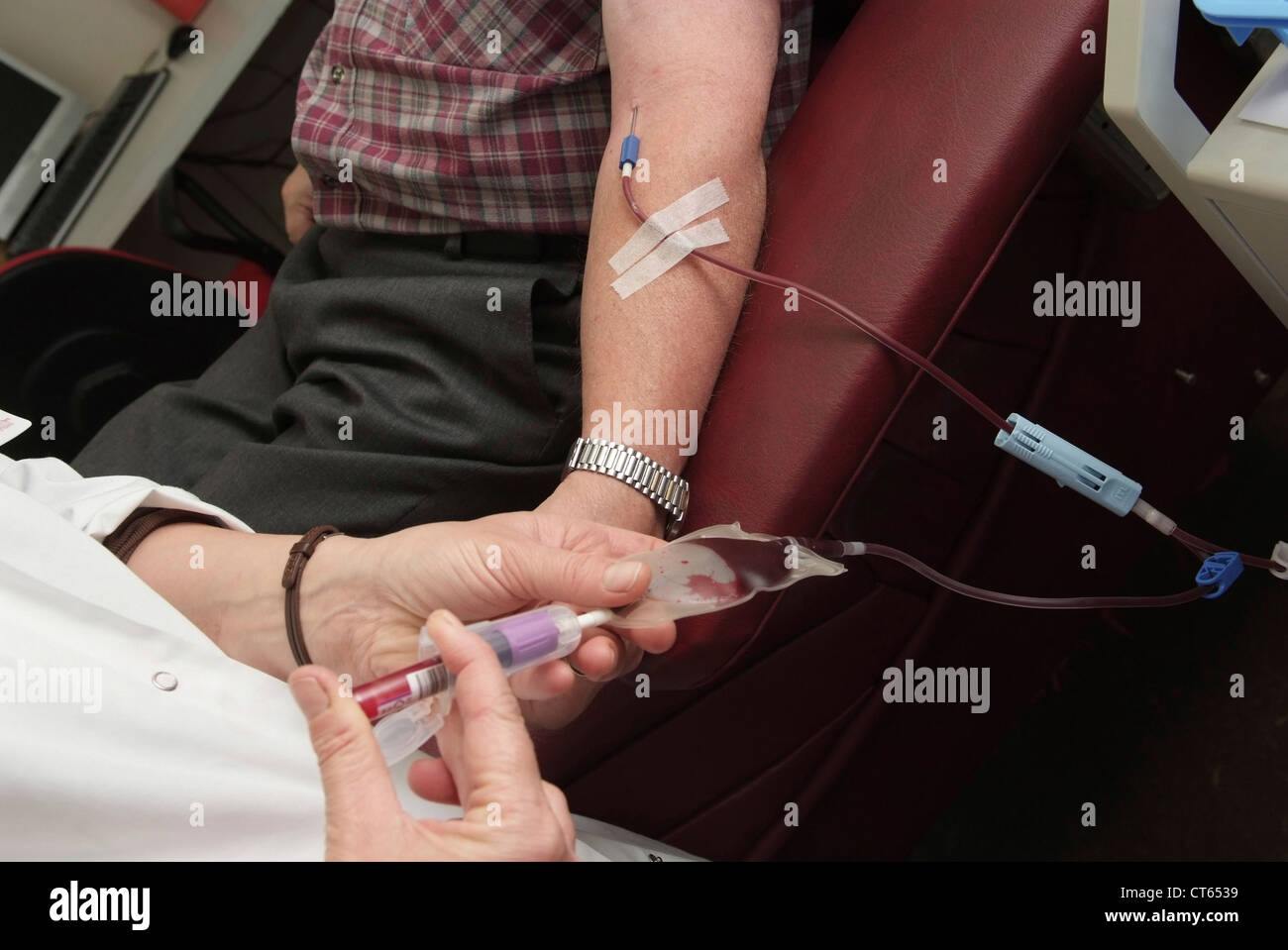 Hemodialysis arm hi-res stock photography and images - Alamy