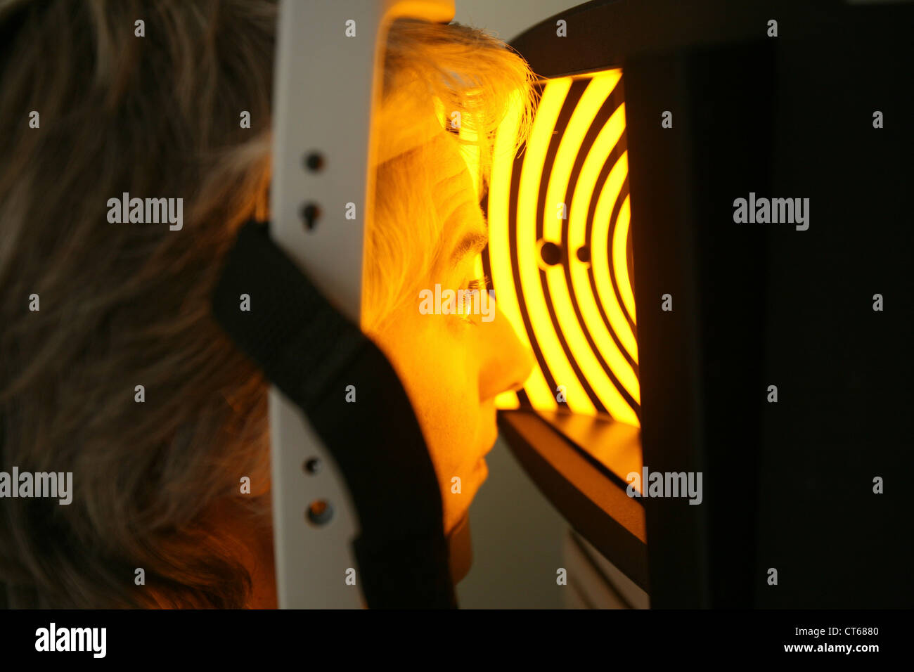CORNEAL TOPOGRAPHY EXAMINATION Stock Photo - Alamy CORNEAL TOPOGRAPHY EXAMINATION Stock Photo - Alamy