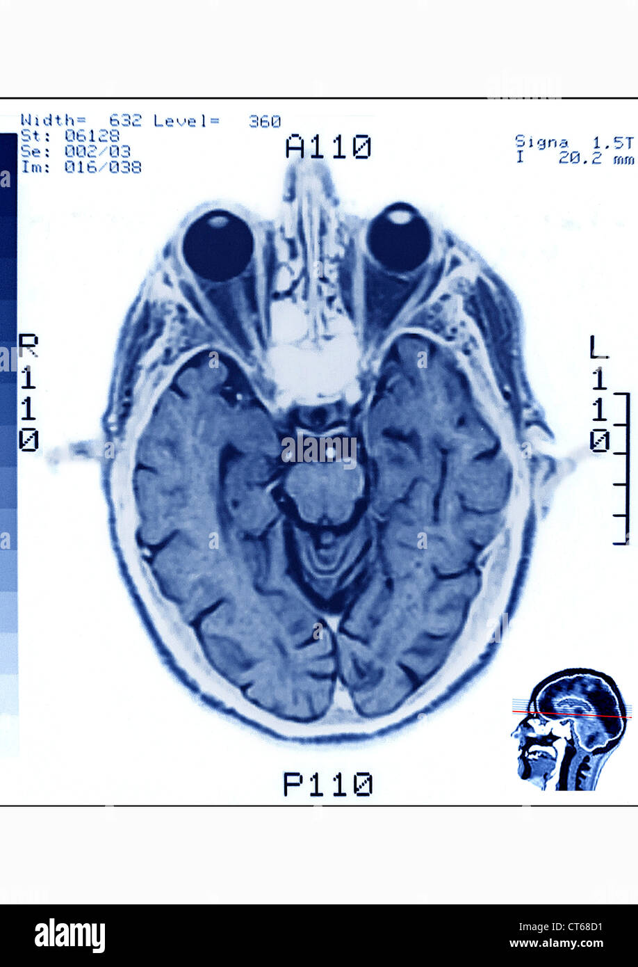 Arteria cortical hi-res stock photography and images - Alamy