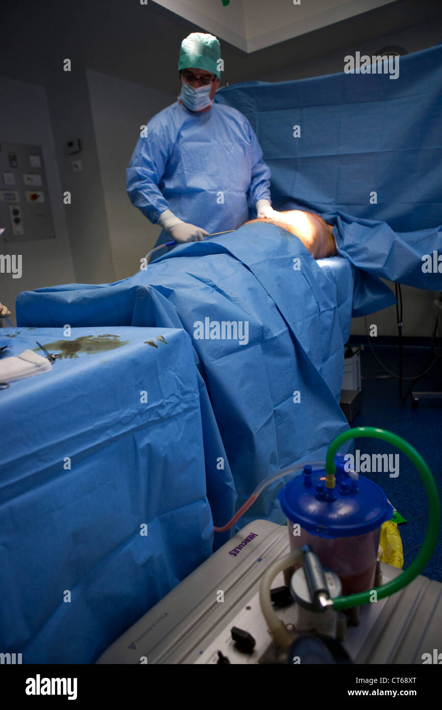 Liposuction cannula hi-res stock photography and images - Alamy