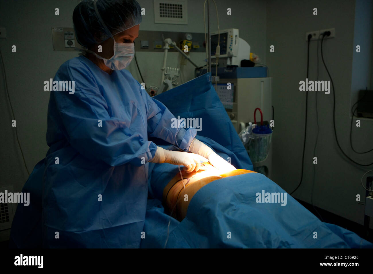 Liposculpture hi-res stock photography and images - Alamy