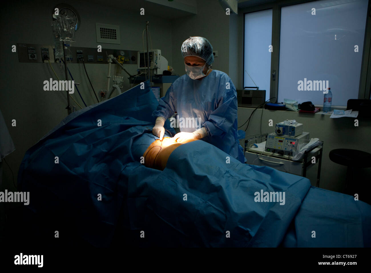 Liposculpture hi-res stock photography and images - Alamy