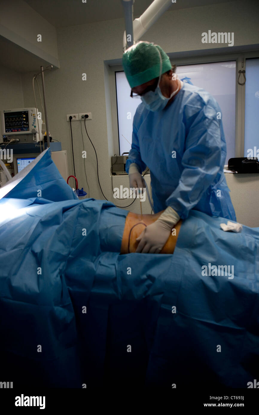 Liposuction cannula hi-res stock photography and images - Alamy