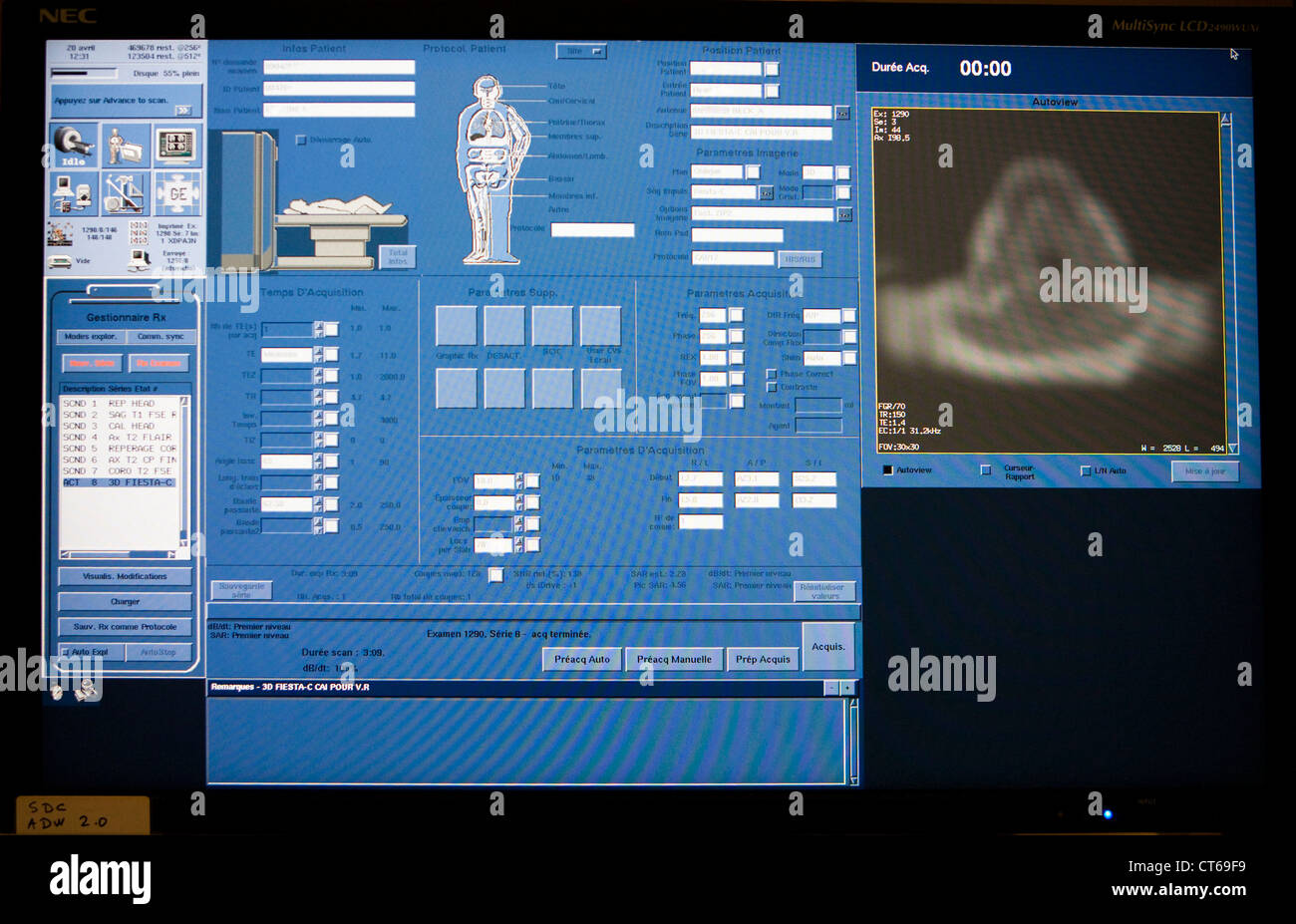 Mri neck hi-res stock photography and images - Alamy
