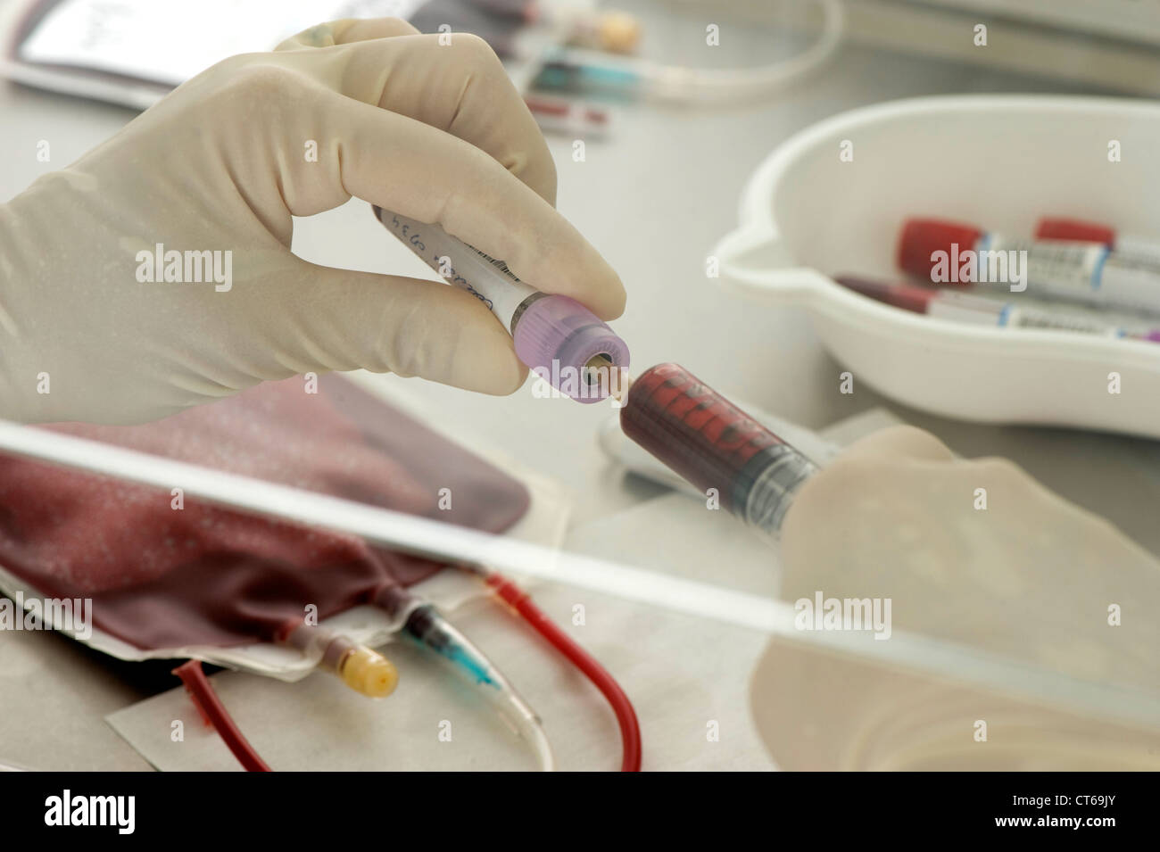 Umbilical cord blood sampling hi-res stock photography and images - Alamy