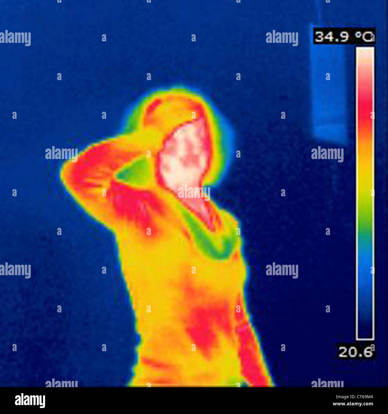 Thermograms hi-res stock photography and images - Alamy