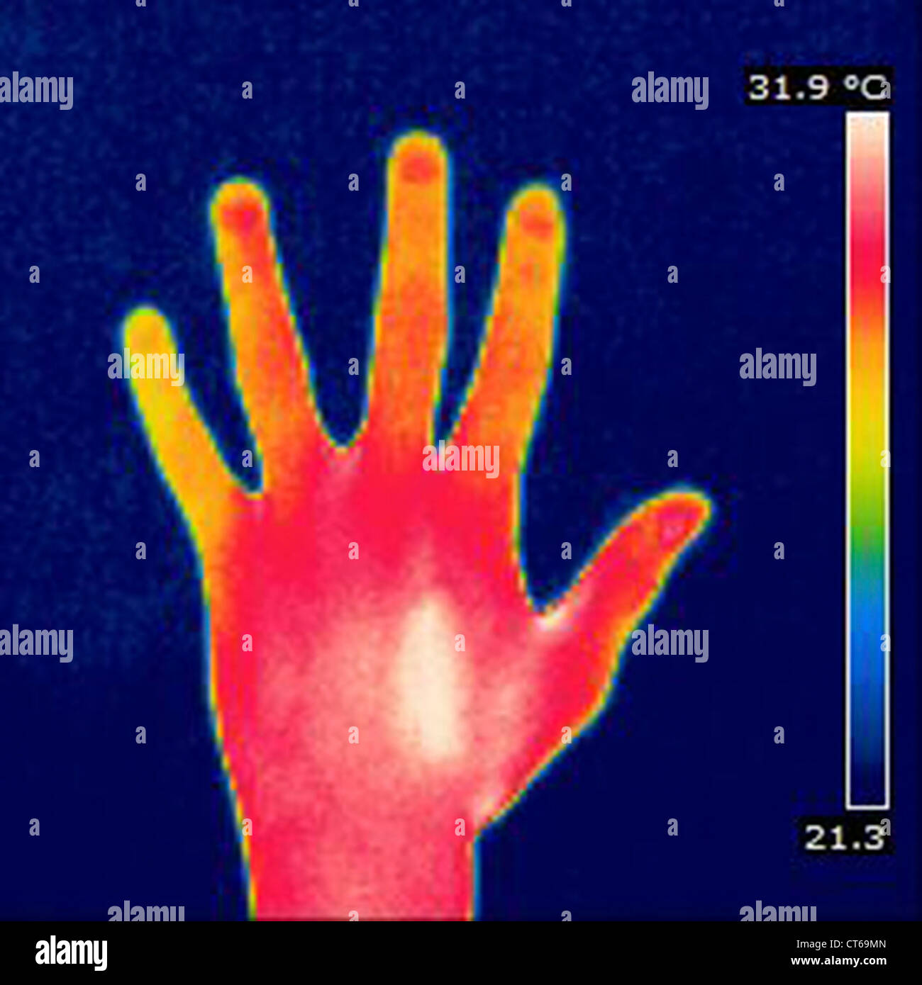 Thermogram hand hi-res stock photography and images - Alamy