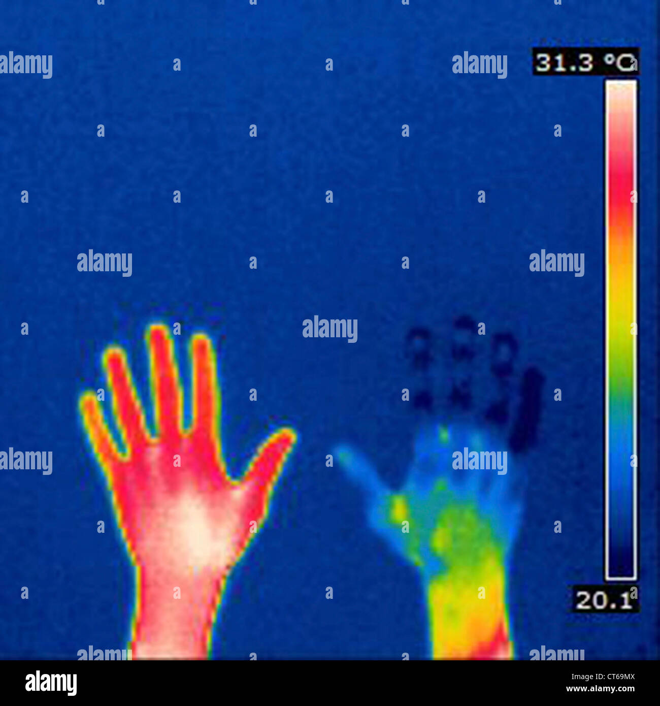 Thermogram hand hi-res stock photography and images - Alamy