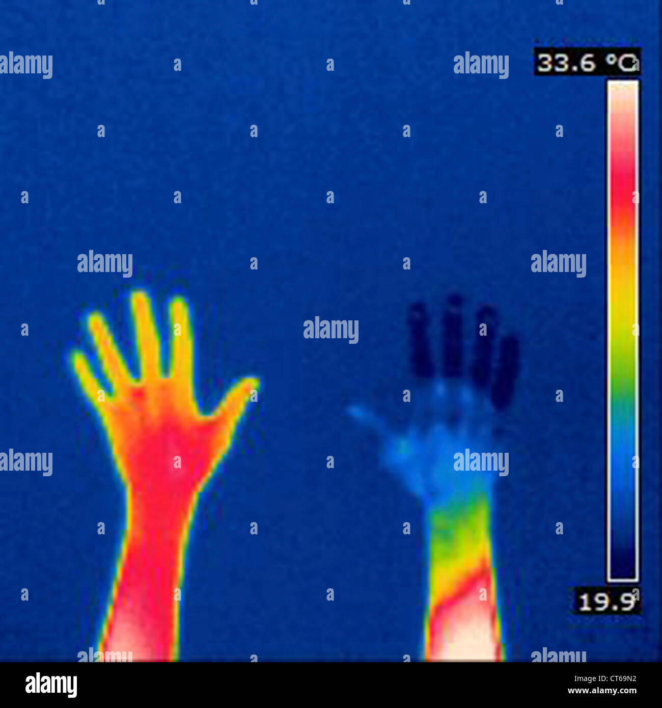 Thermogram hand hi-res stock photography and images - Alamy