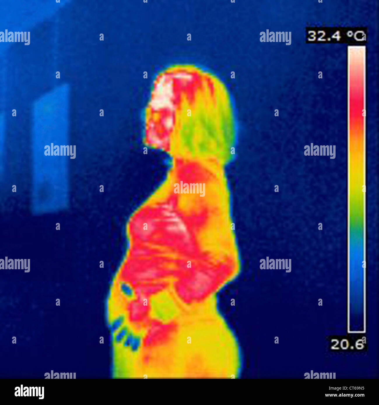 Thermograms hi-res stock photography and images - Alamy