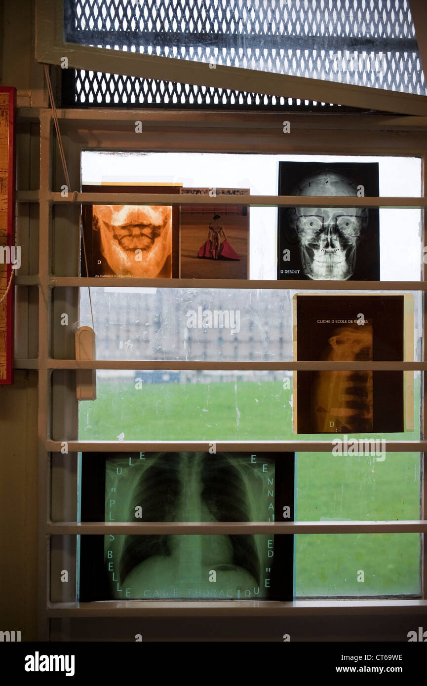 Medical x ray humor hi-res stock photography and images - Alamy