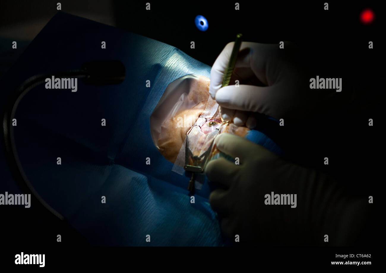 Lady laser eye surgery hi-res stock photography and images - Alamy