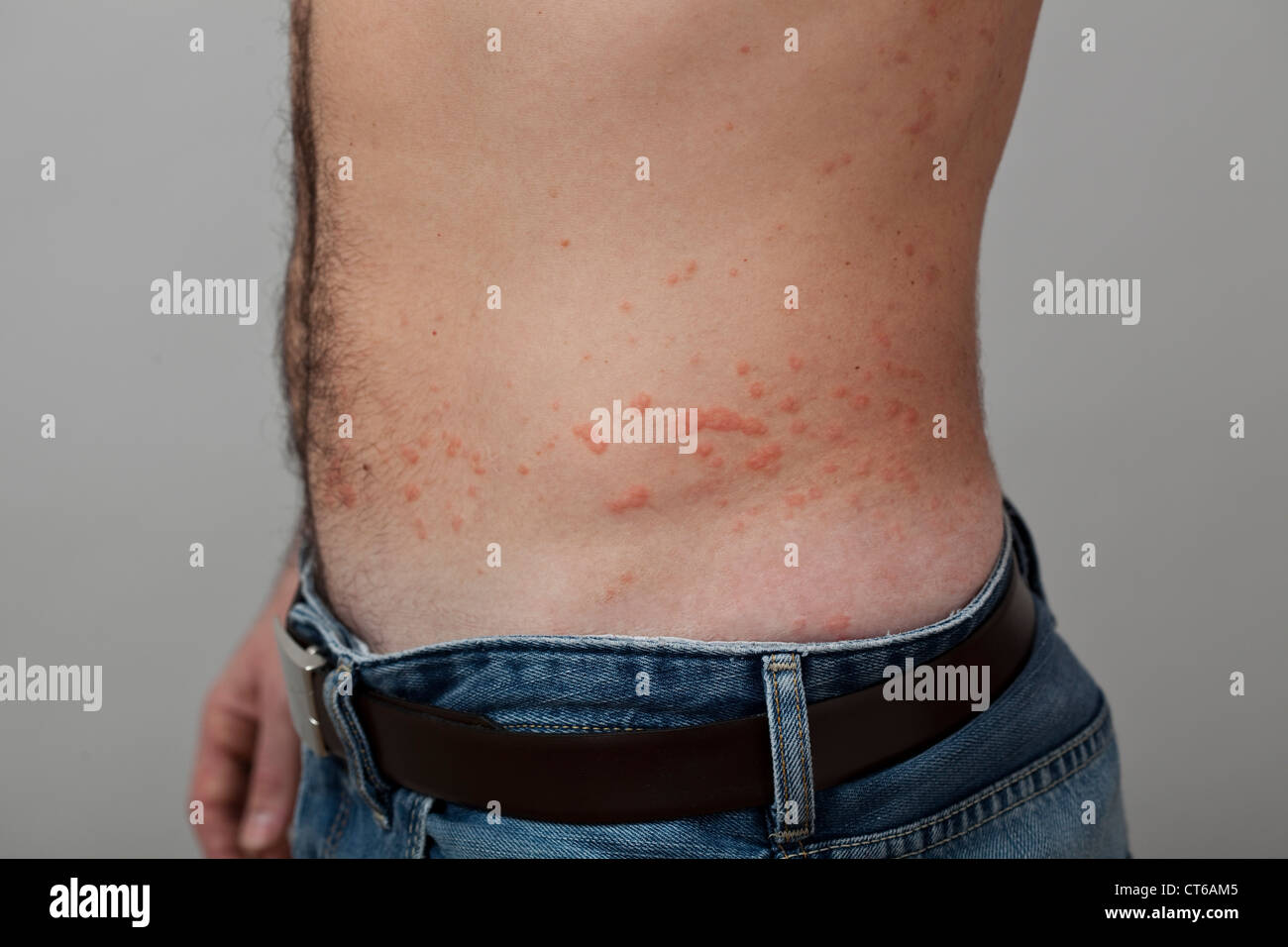 Side view of the male pelvis hi-res stock photography and images - Alamy