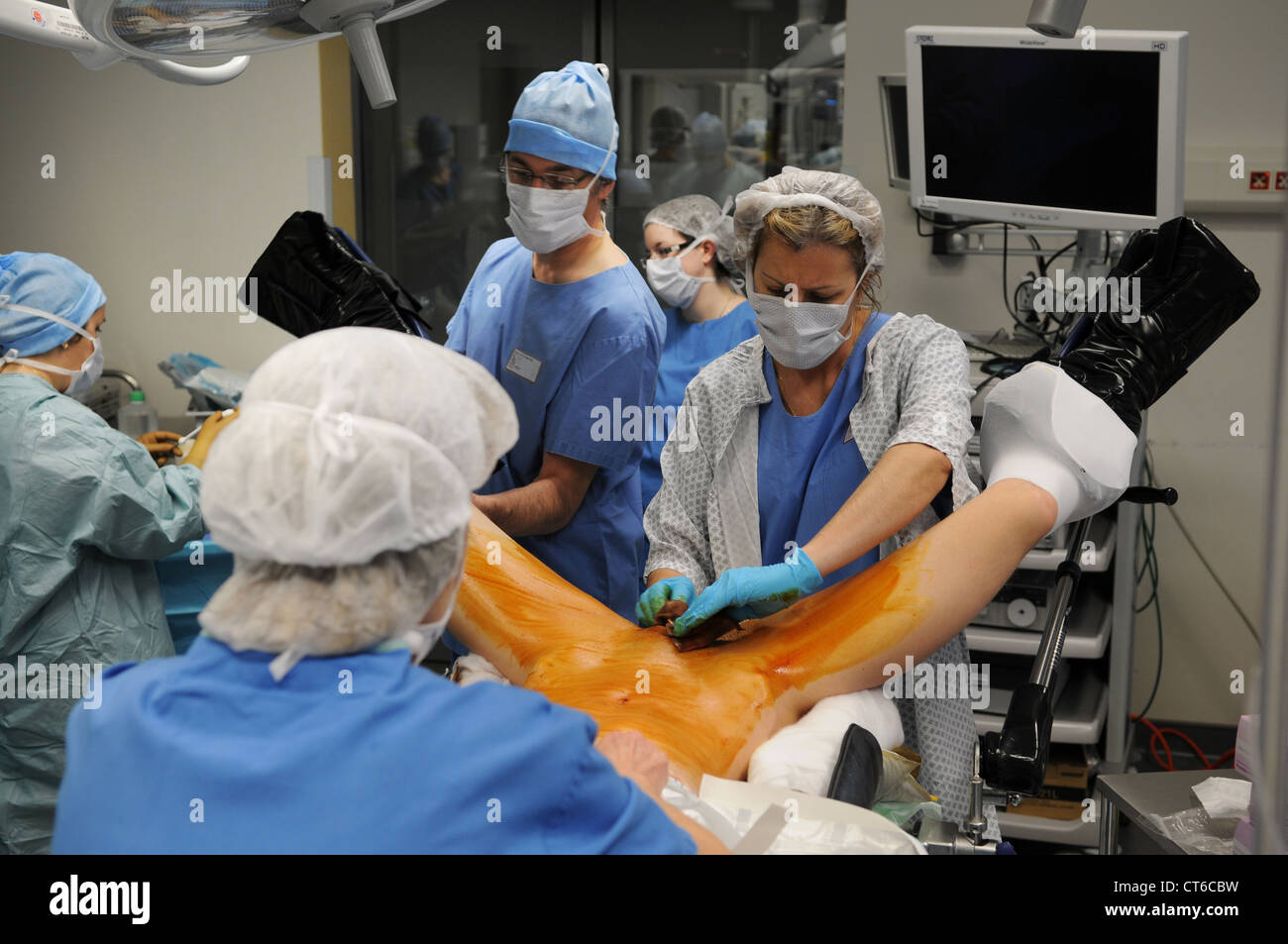 Hystero Ovariectomy High Resolution Stock Photography and Images - Alamy