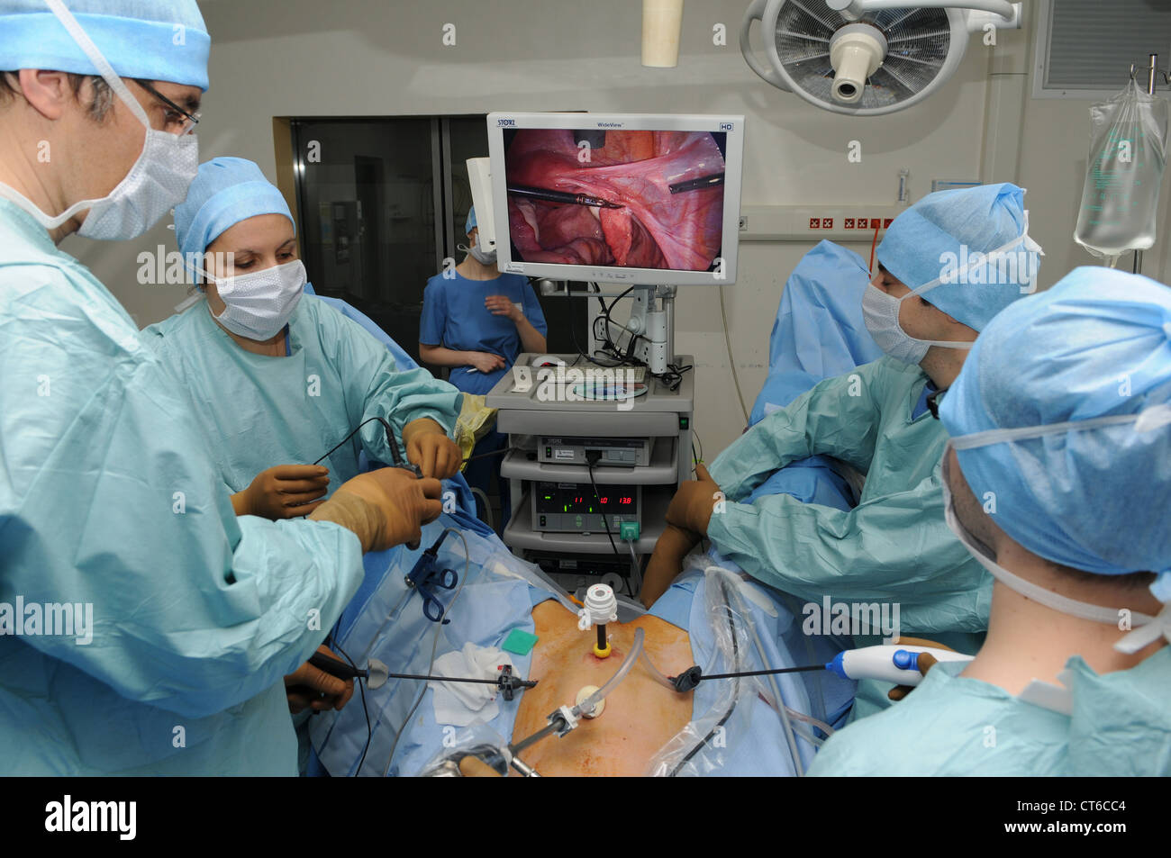 Hystero ovariectomy hi-res stock photography and images - Alamy