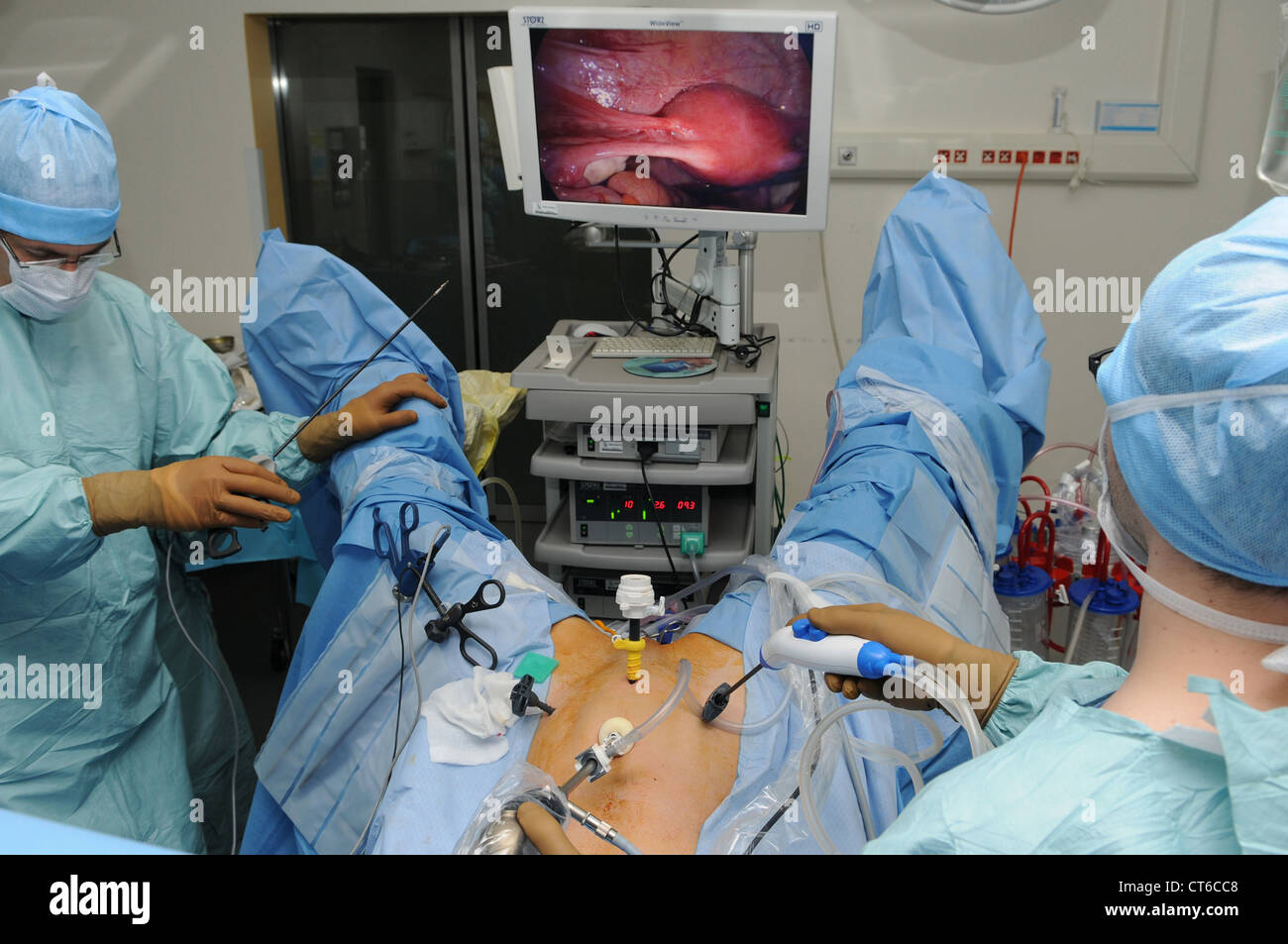 Hystero ovariectomy hi-res stock photography and images - Alamy