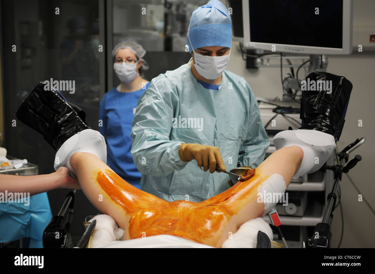 HYSTERO-OVARIECTOMY Stock Photo - Alamy