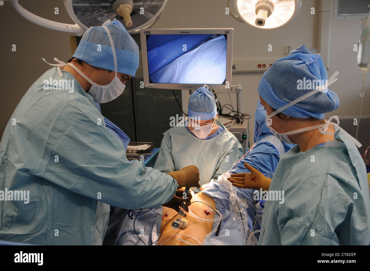 Hystero ovariectomy hi-res stock photography and images - Alamy
