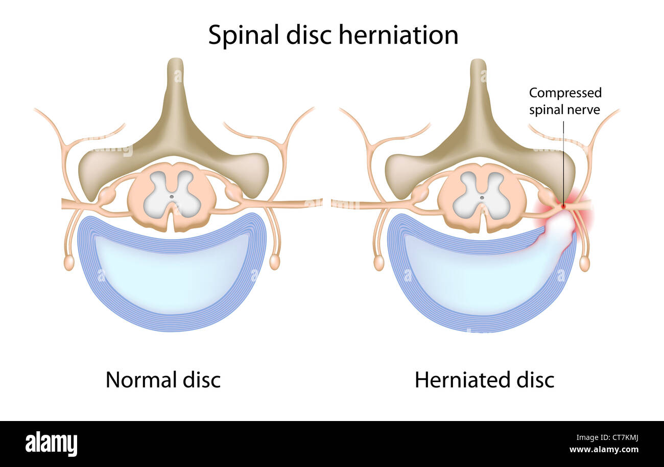 Diagram of the spinal cord hi-res stock photography and images - Alamy