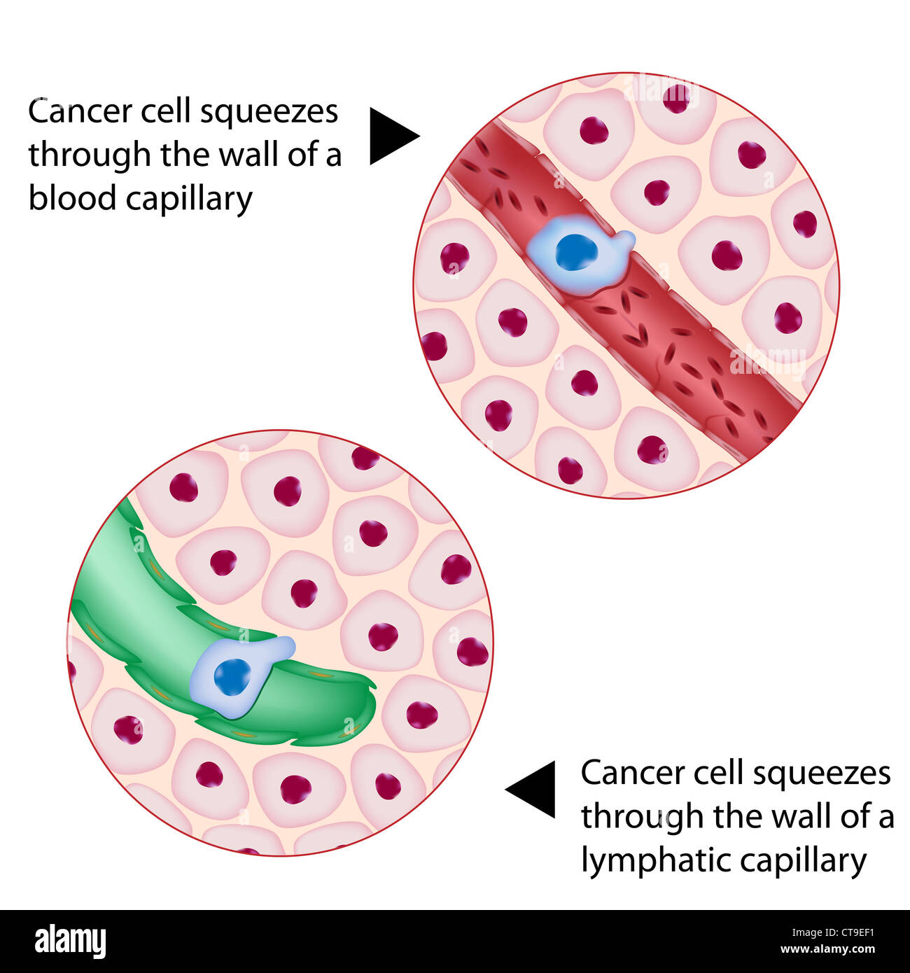 Cancer cell squeezes through blood and lymph vessel Stock Photo - Alamy