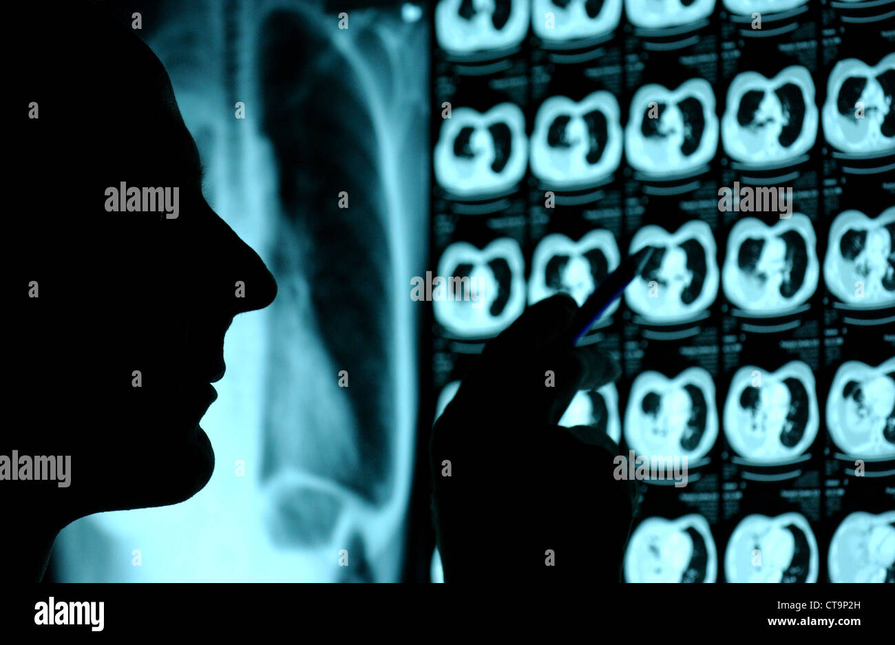 London, doctor assesses Roentgen and CT scans Stock Photo - Alamy