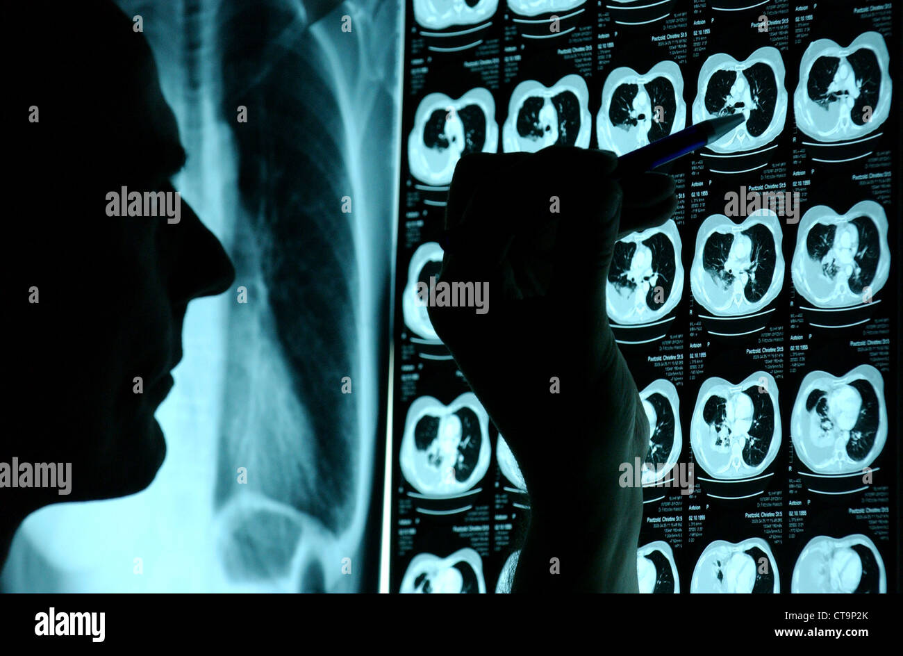 Ct scans horizontal hi-res stock photography and images - Alamy