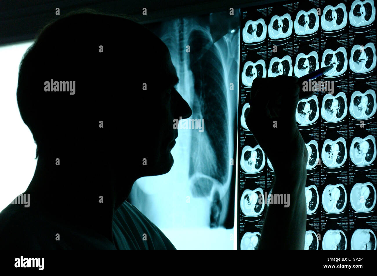 Ct Scans Horizontal High Resolution Stock Photography and Images - Alamy