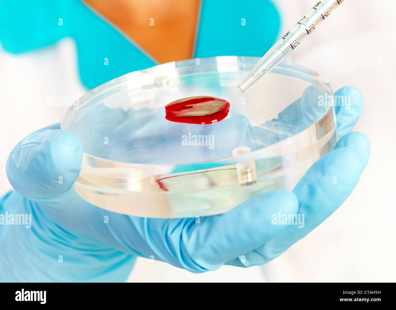 hand doc holds the test for blood Stock Photo - Alamy