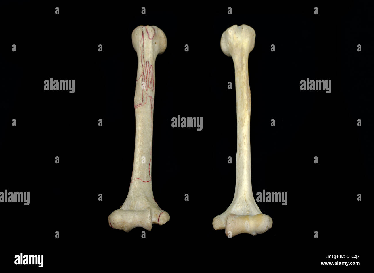 Left Humerus Anterior View