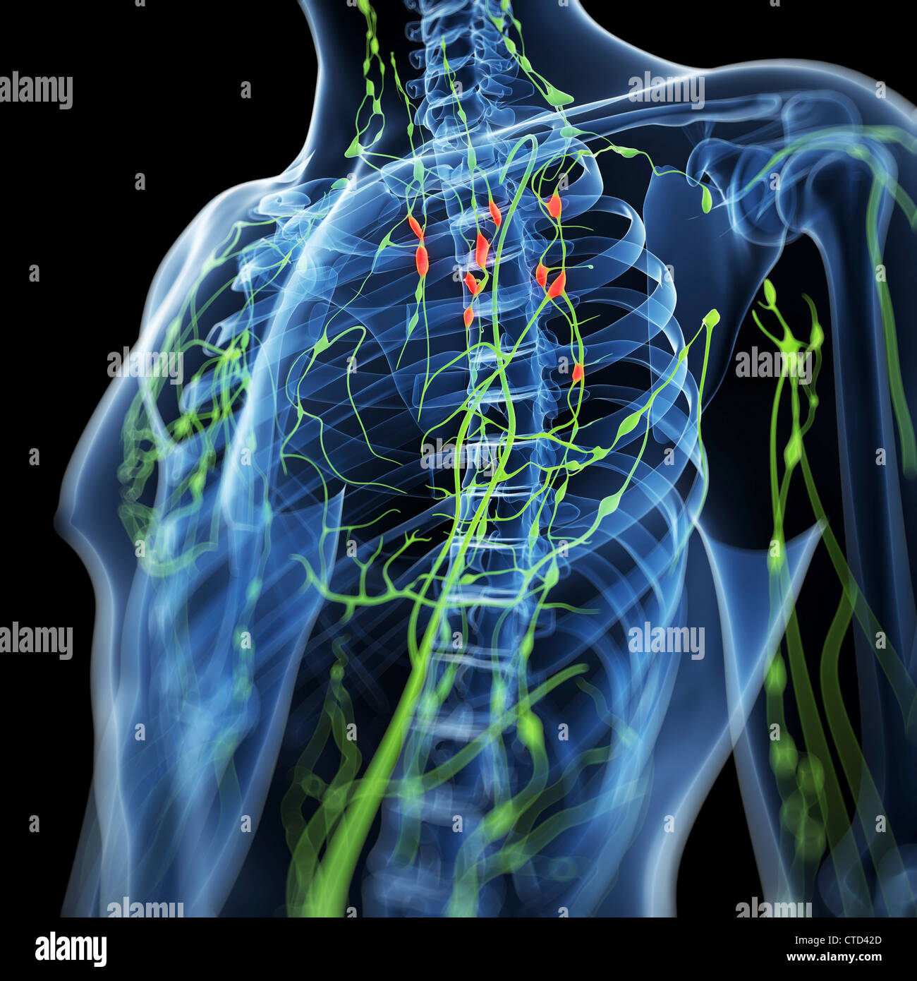 Lymph node inflammation hi-res stock photography and images - Alamy