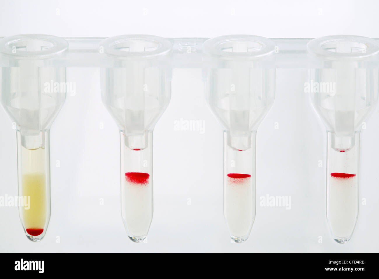 Blood Group Test Stock Photo Alamy blood-group-test-stock-photo-alamy