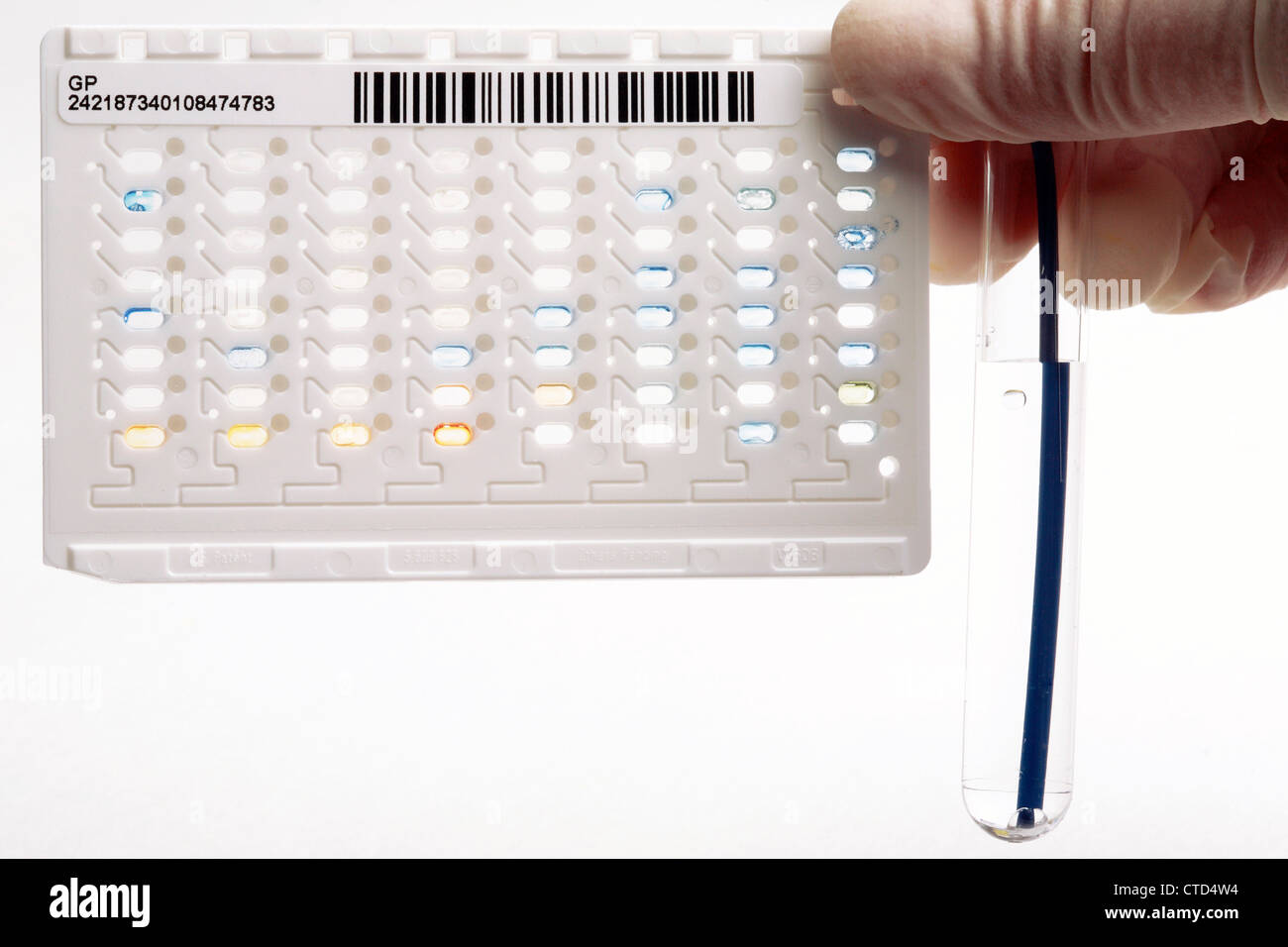 Blood group test hi-res stock photography and images - Alamy