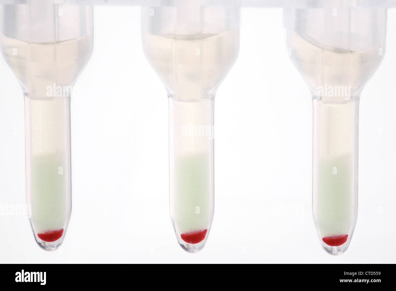 Blood group test Stock Photo - Alamy