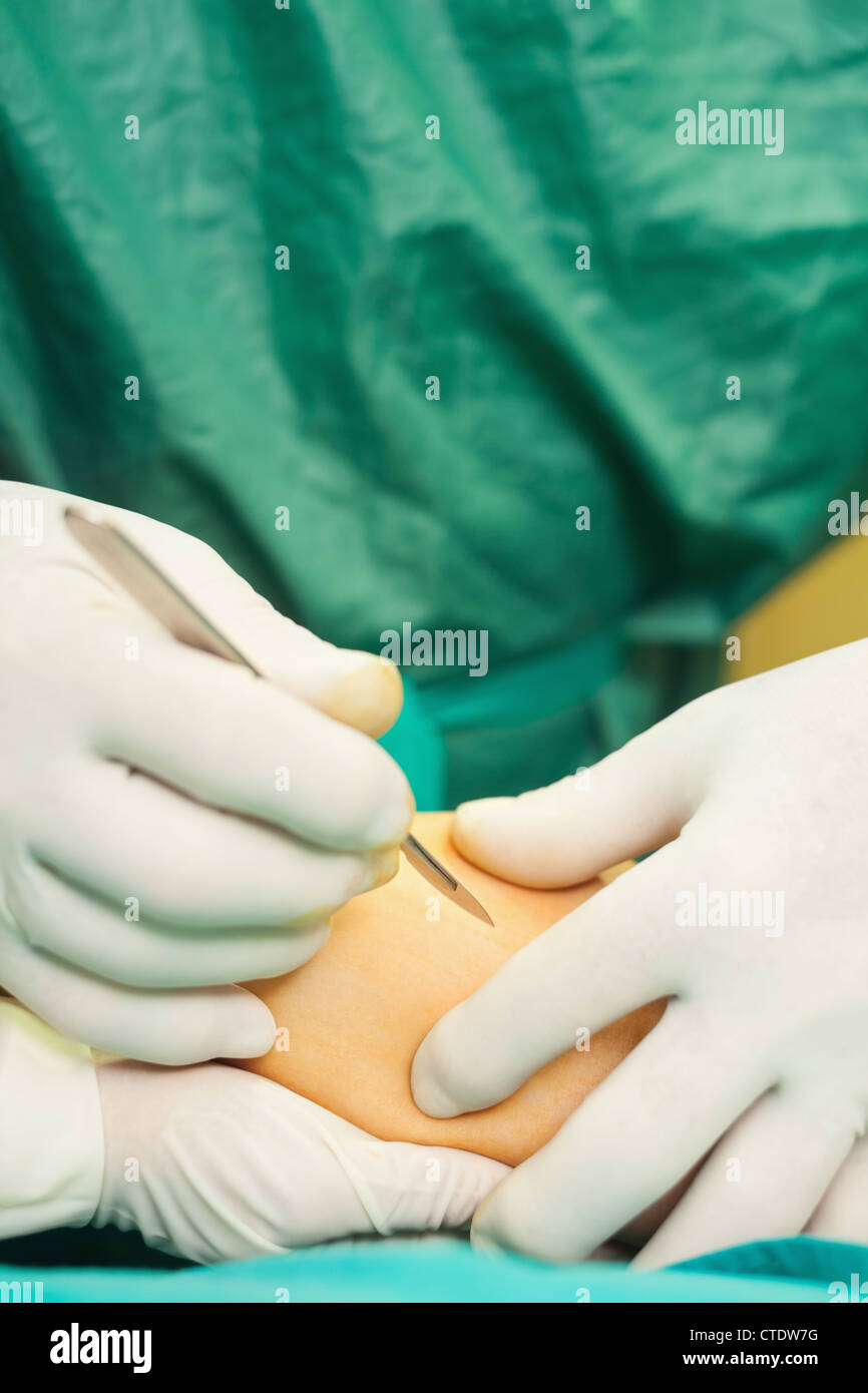 Close up scalpel hi-res stock photography and images - Alamy