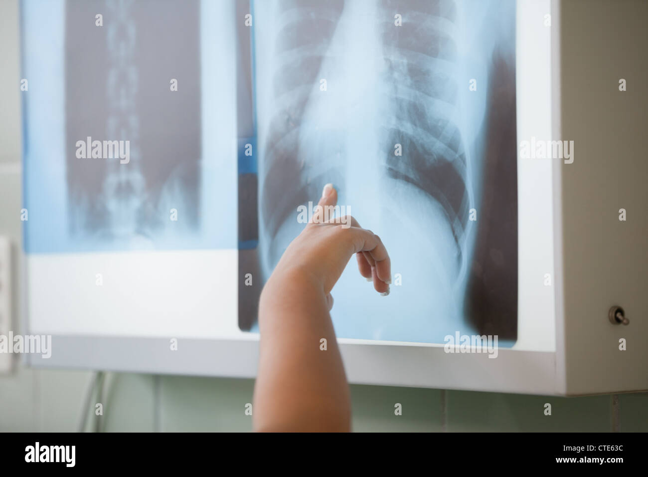 Close up of people showing a X-ray Stock Photo - Alamy