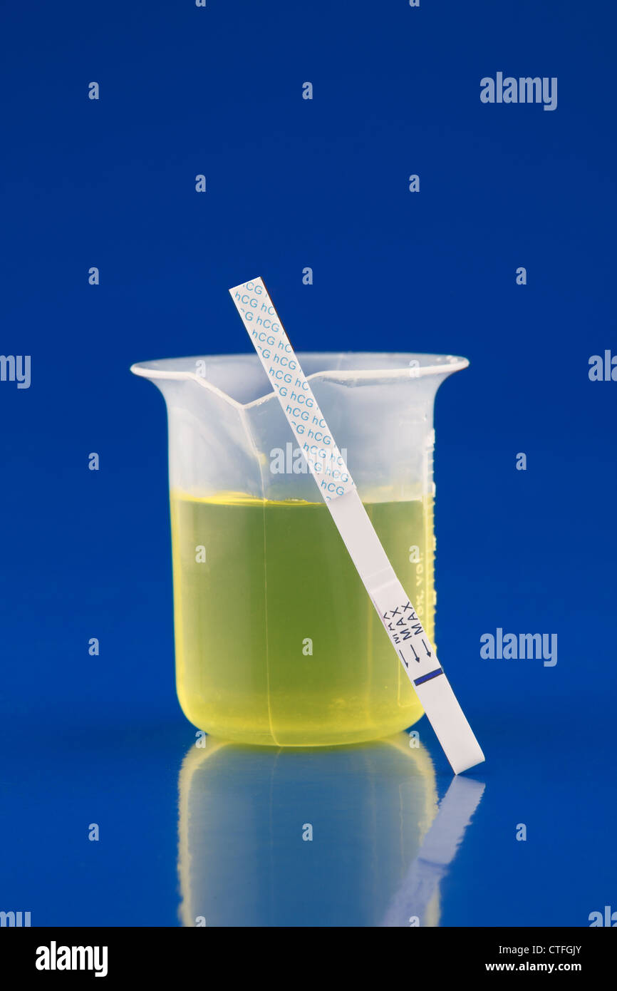 HCG pregnancy test with a sample of urine Stock Photo - Alamy
