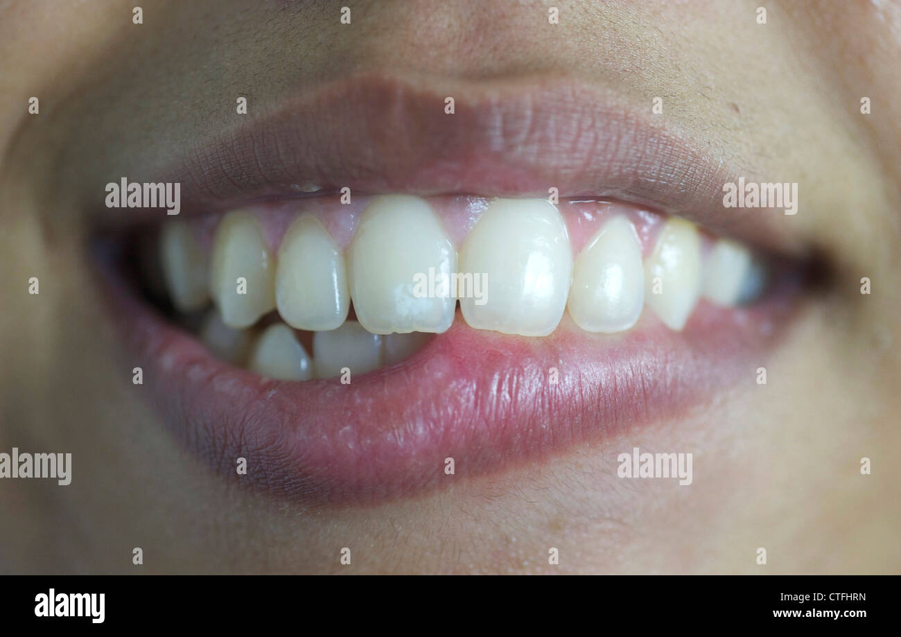 Teenage kids mouth close up teeth lips biting ones lip Indian dark skin ...