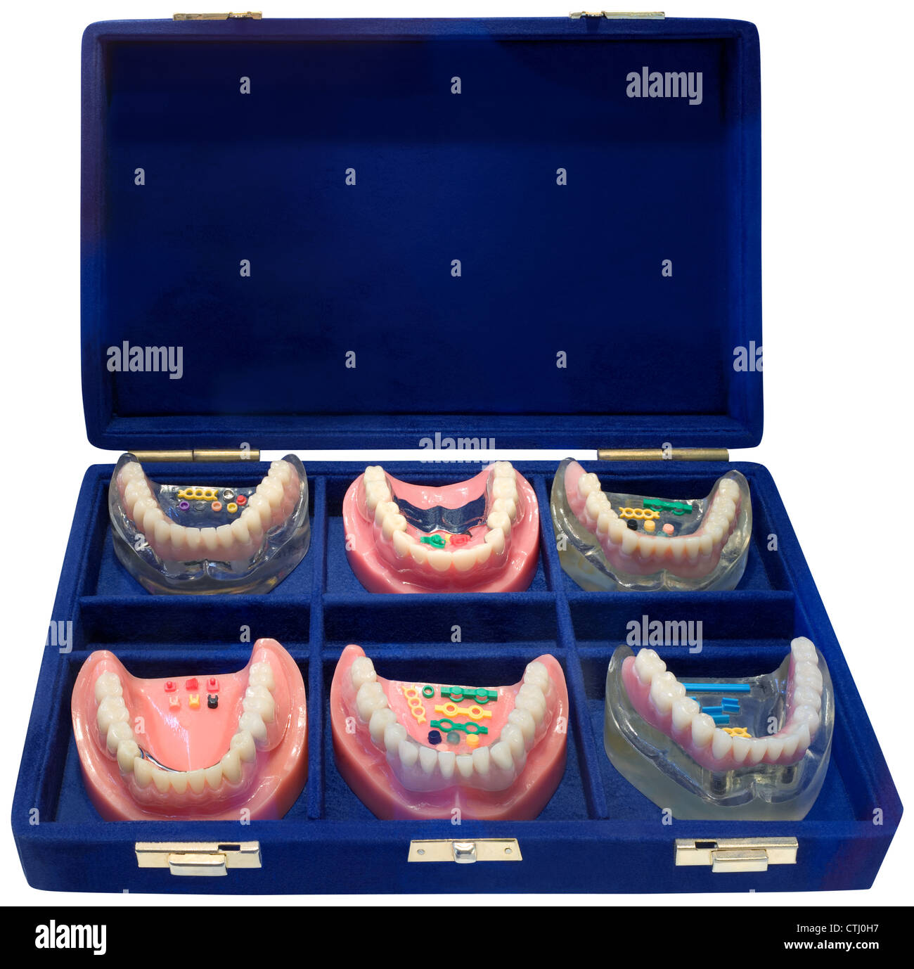 Set of Six Different Color Denture Models cutout Stock Photo - Alamy