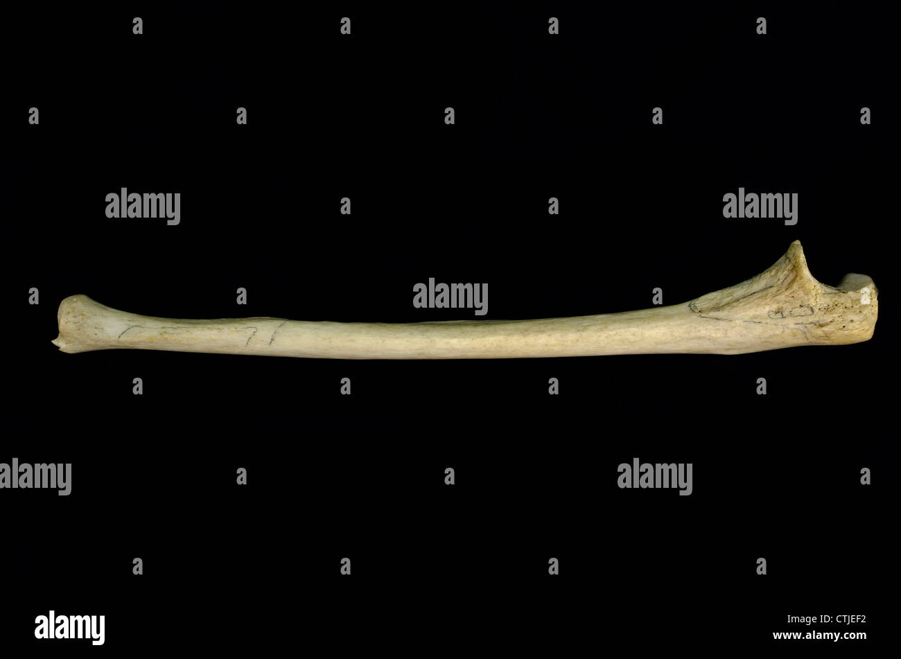Human Arm Bone High Resolution Stock Photography and Images - Alamy