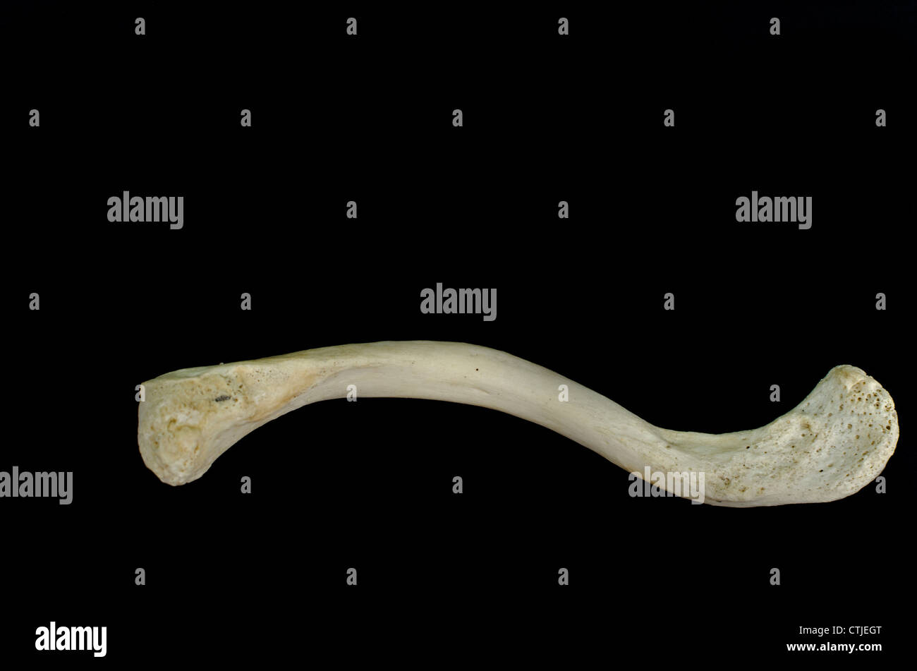 Clavicle Fracture High Resolution Stock Photography and Images - Alamy