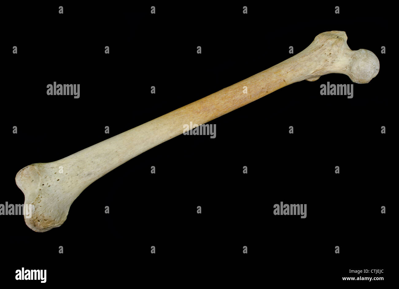 Femur Bone High Resolution Stock Photography and Images - Alamy