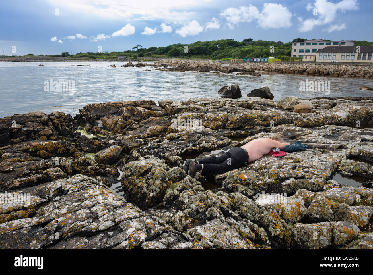 Sunburn hi-res stock photography and images - Alamy