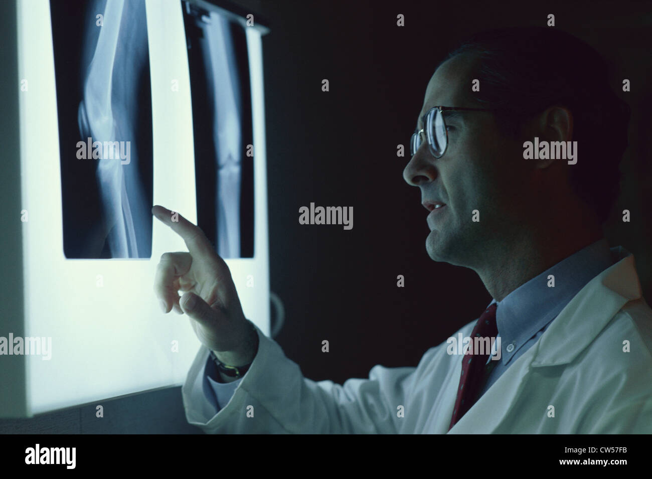 Close-up of a male doctor looking at x-rays on a lightbox Stock Photo ...