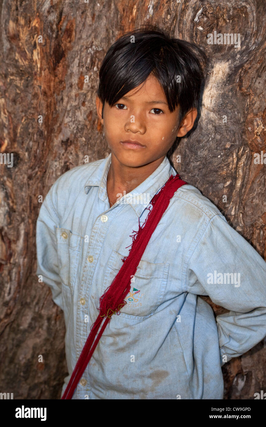 Myanmar, Burma. Young Burmese Boy in Village near Bagan. He has traces ...
