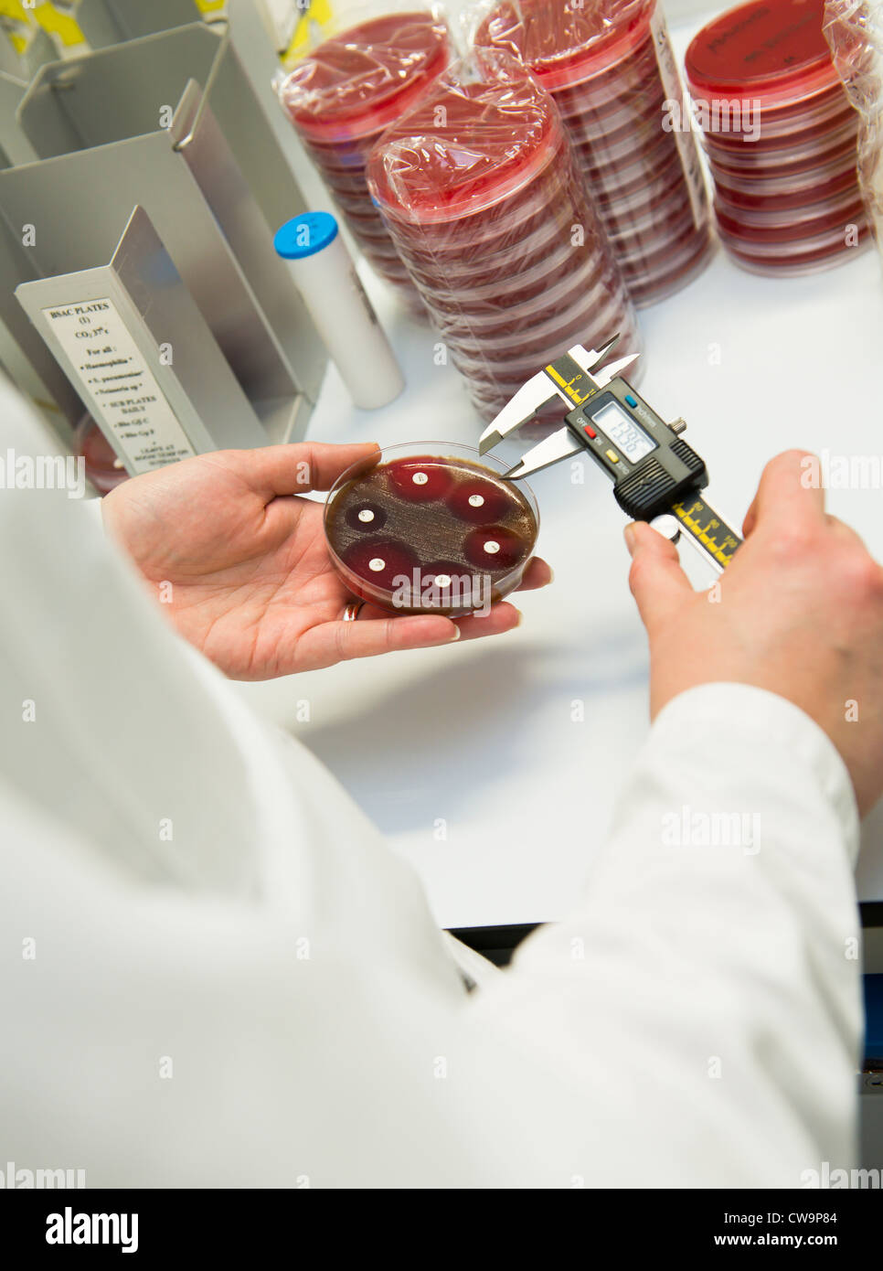 Queen Elizabeth Hospital Birmingham. Labs. University Hospitals ...