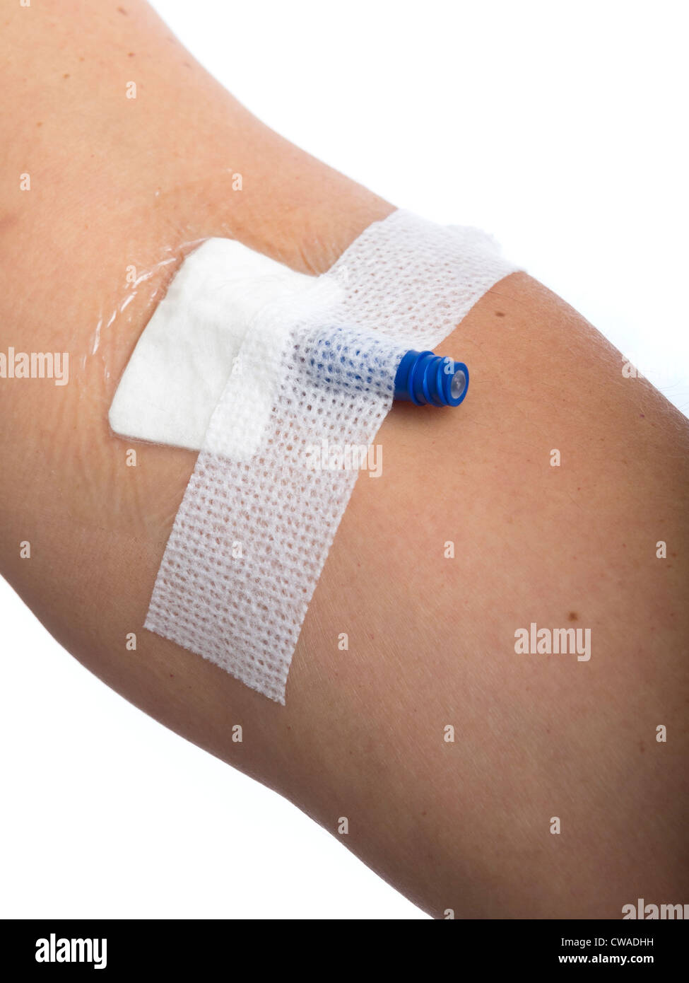 Iv Drip Woman High Resolution Stock Photography and Images - Alamy