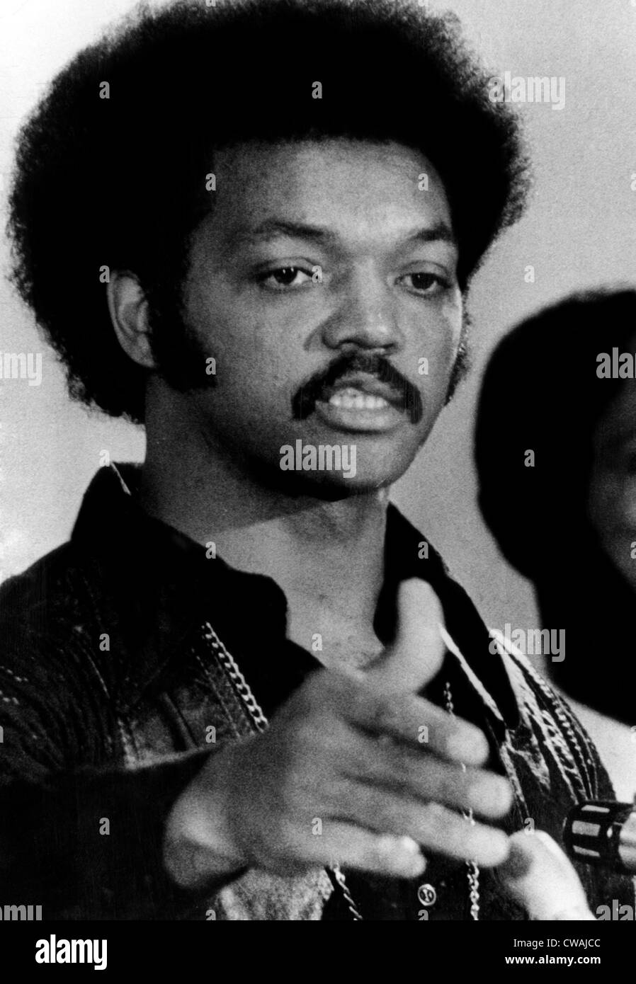 Jesse Jackson Cleft Lip