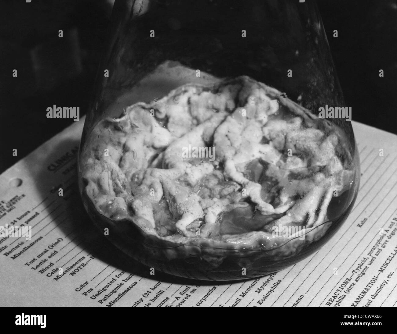 Penicillin mold hi-res stock photography and images - Alamy