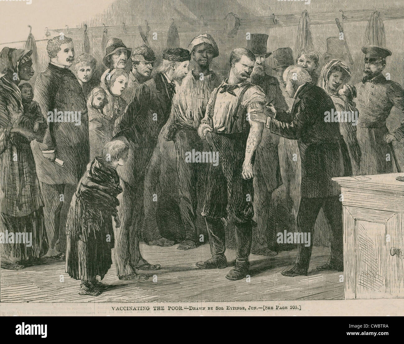 Smallpox 19th century hi-res stock photography and images - Alamy