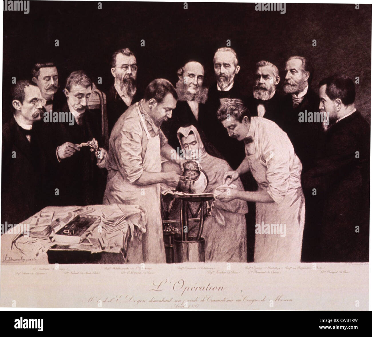 Eugene Louis Doyen (1859-1916), eminent French surgeon, performing ...